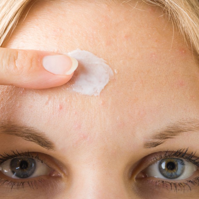 Rash On Forehead